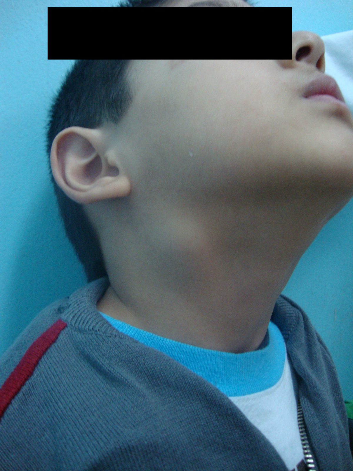 Infecciosas - Dr. Juan Ore